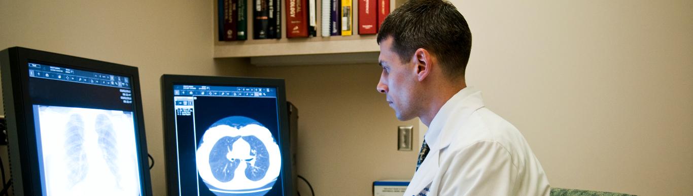 Lung & Thoracic Cancer | MUSC Hollings Cancer Center