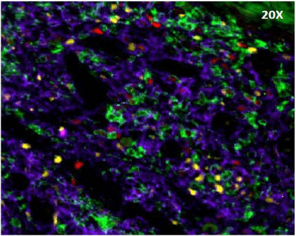 Biorepository & Tissue Analysis Shared Resource | MUSC Hollings Cancer ...